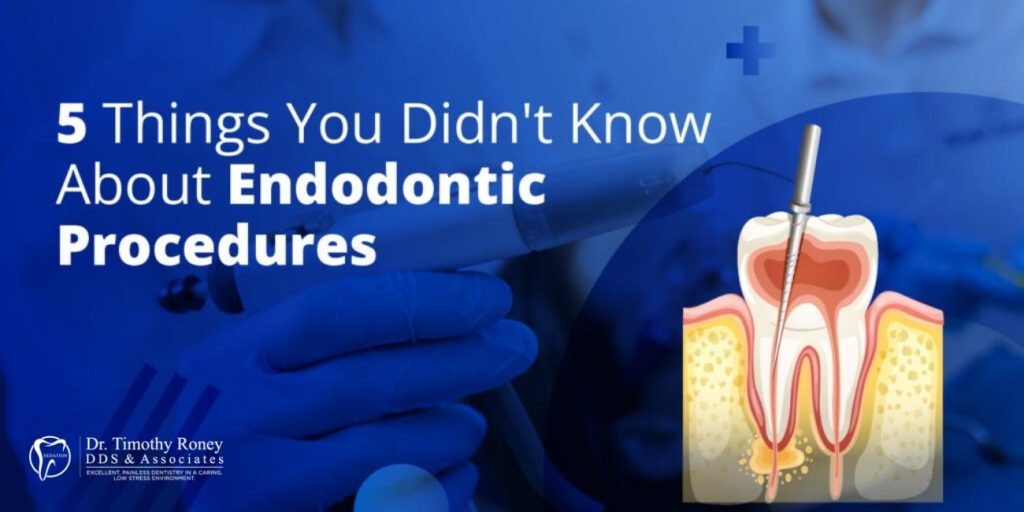 Five Things You Didn’t Know About Endodontic Procedures - Dr Timothy ...